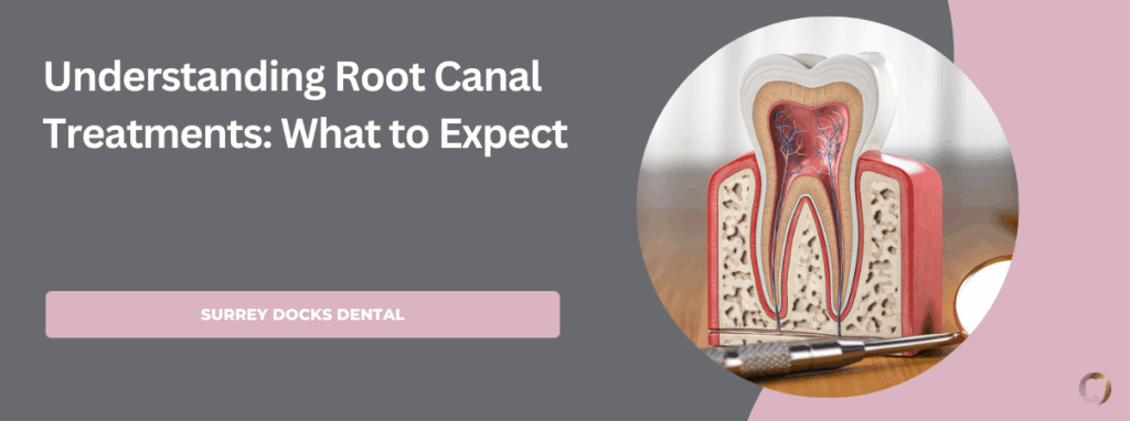 Understanding Root Canal Treatments: What to Expect